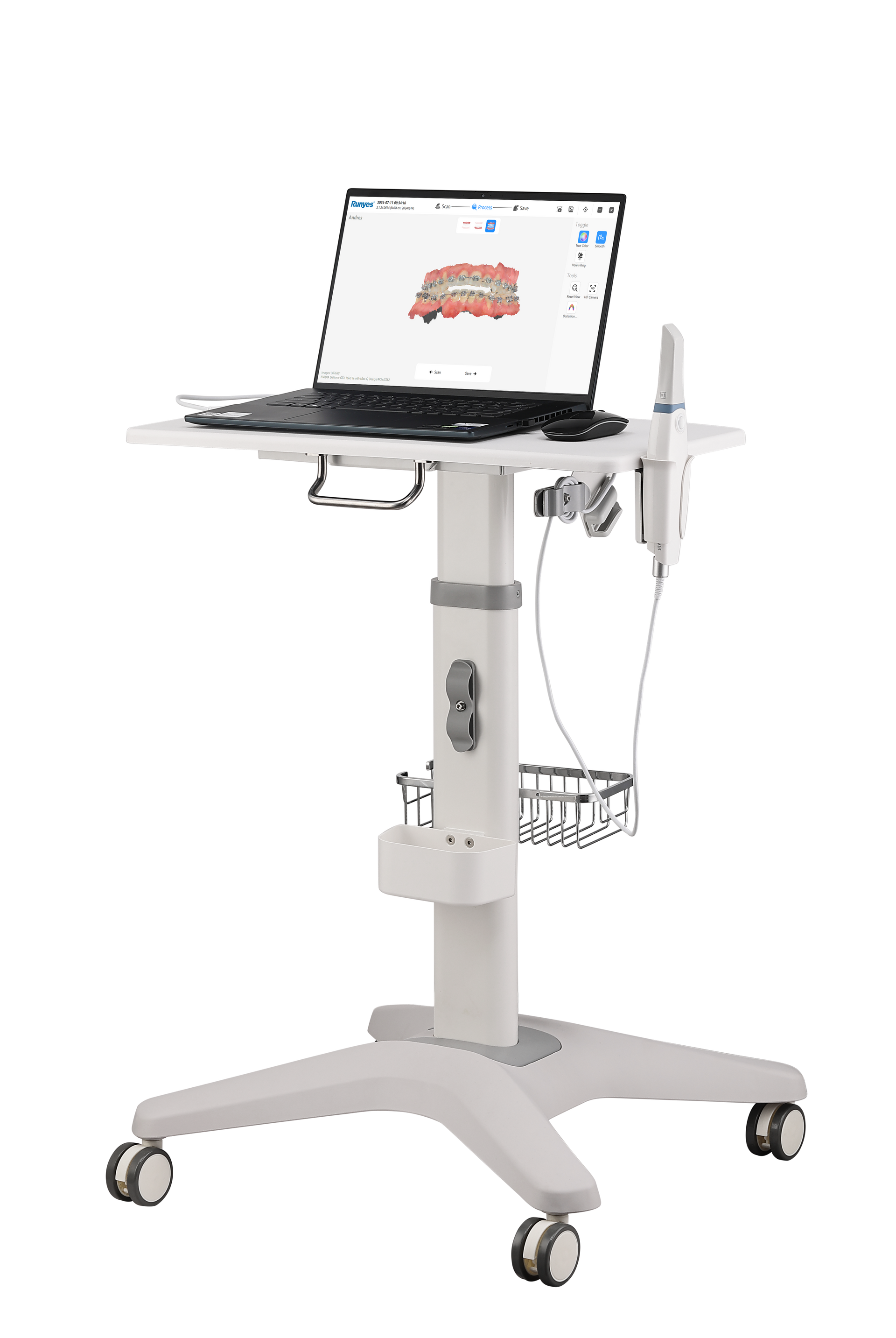 Universal Intraoral Mobile Cart for Intraoral Scanners
